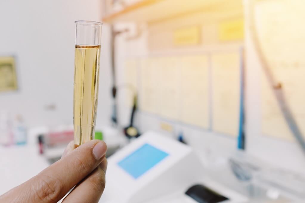 Toxicology: Drug Testing - Clarity Labs